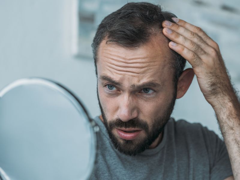 5 tratamientos para la caída del cabello en hombres y mujeres - Ghorchi ...
